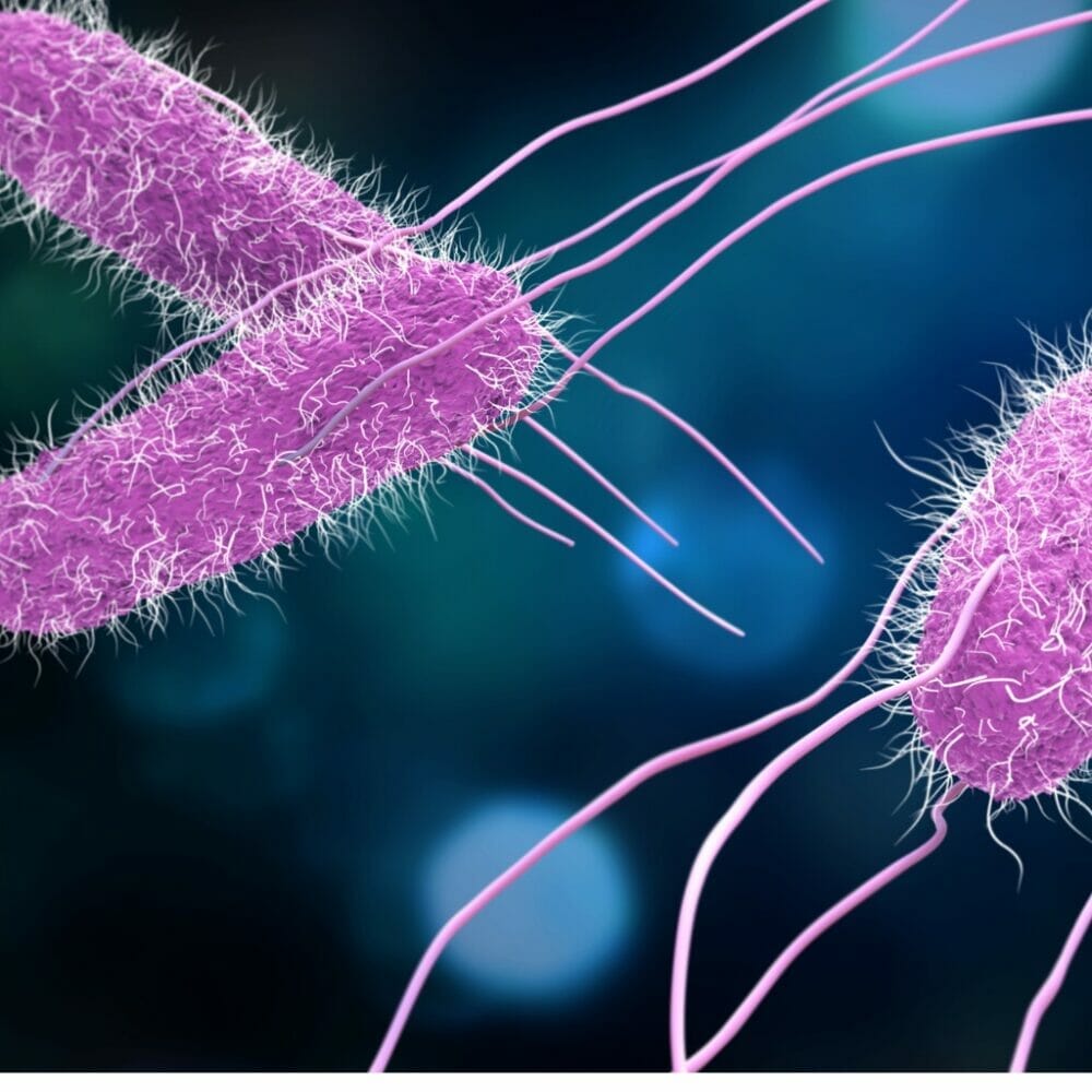 What is Food Poisoning? Everything You Need to Know | STOP